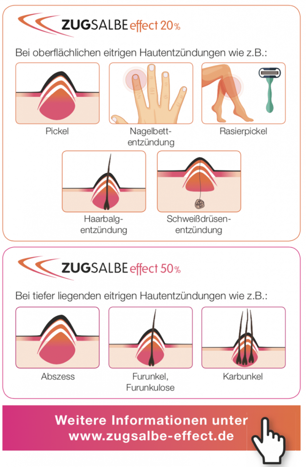 Abszesse und Furunkel • InfectoPharm Wissen wirkt.